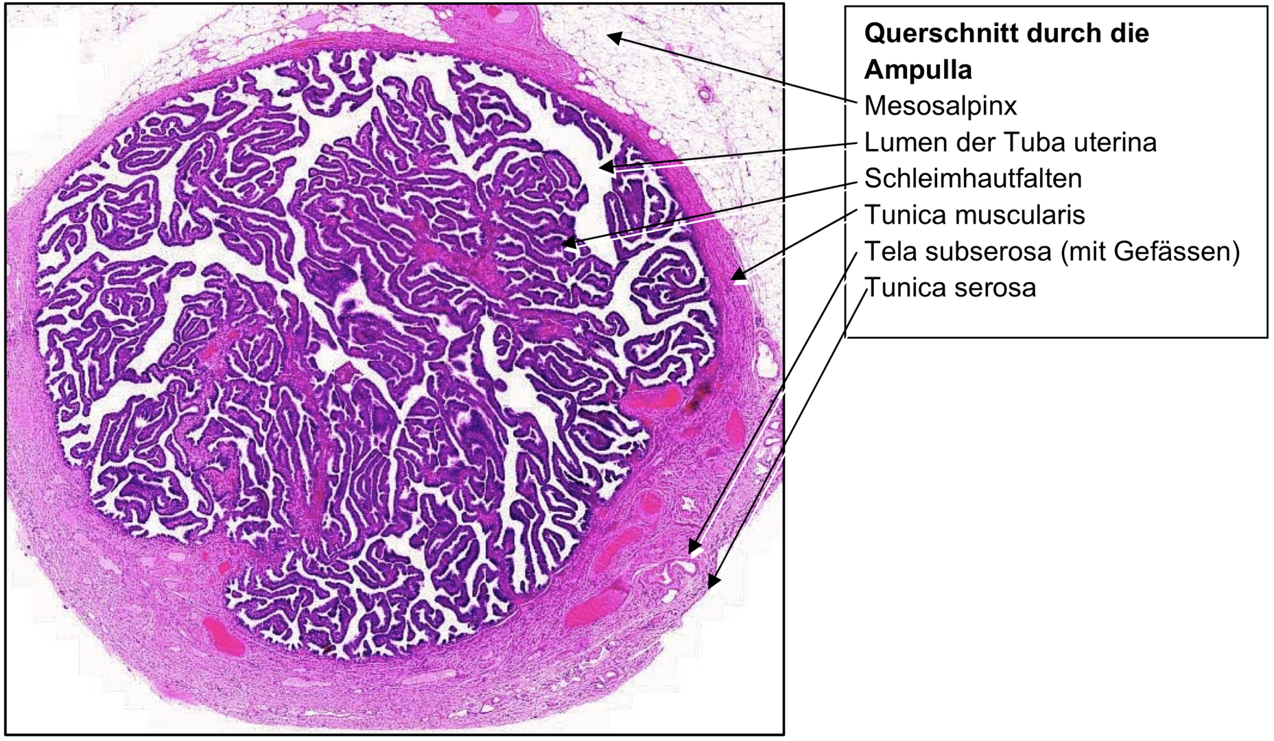 Eileiter Tuba Uterina Eileiter Tuba Uterina